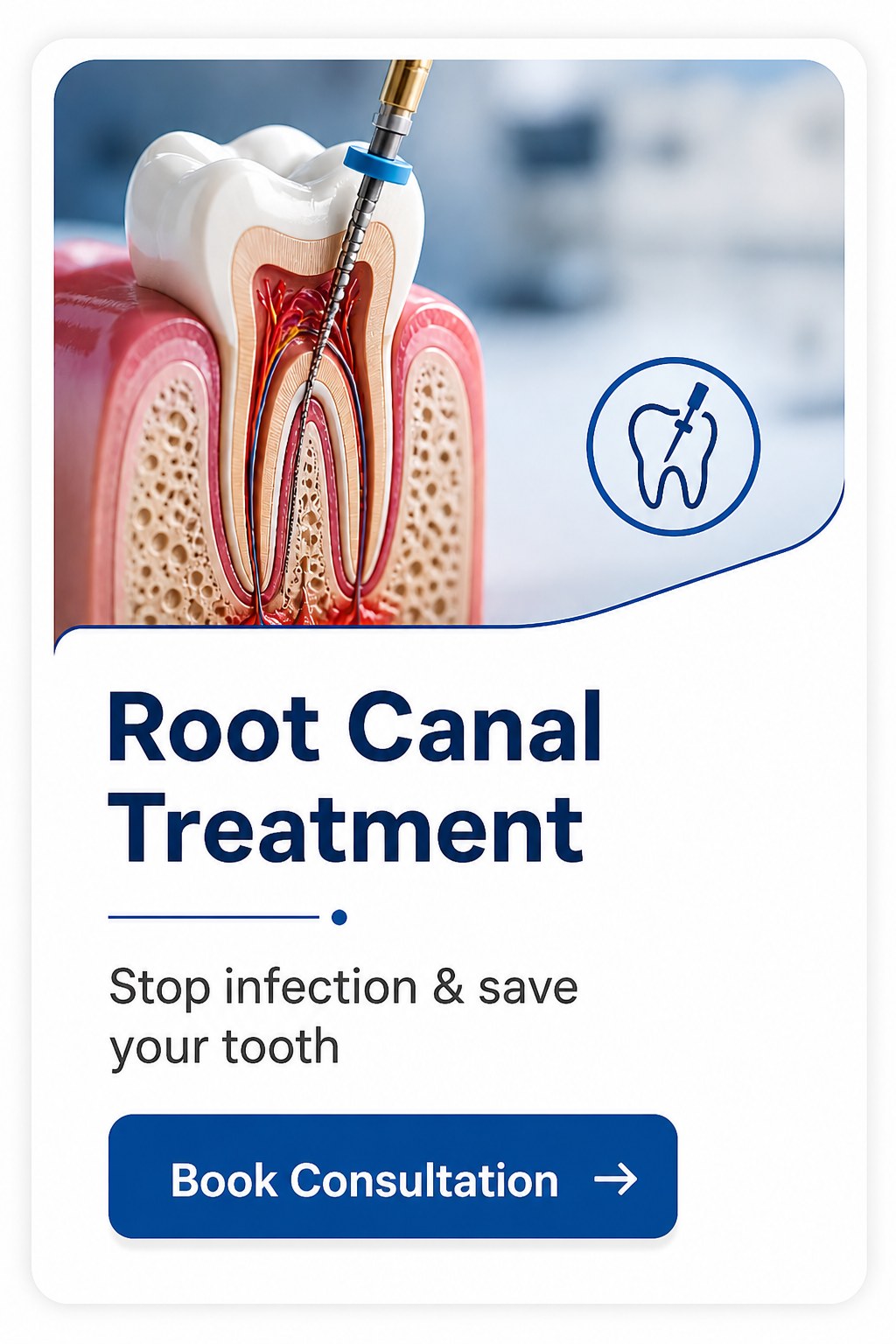 Gum Graft Surgery: What to Expect & How It Helps Receding Gums